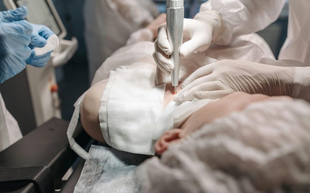 Here are 5 facts you should know before getting a BBL - K24 Digital